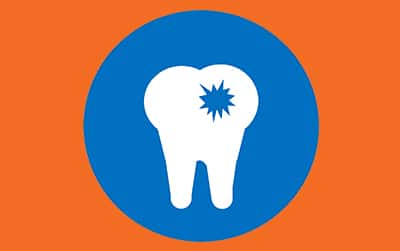 Silver Diamine Fluoride (SDF): What You Should Know - Children's Dental ...